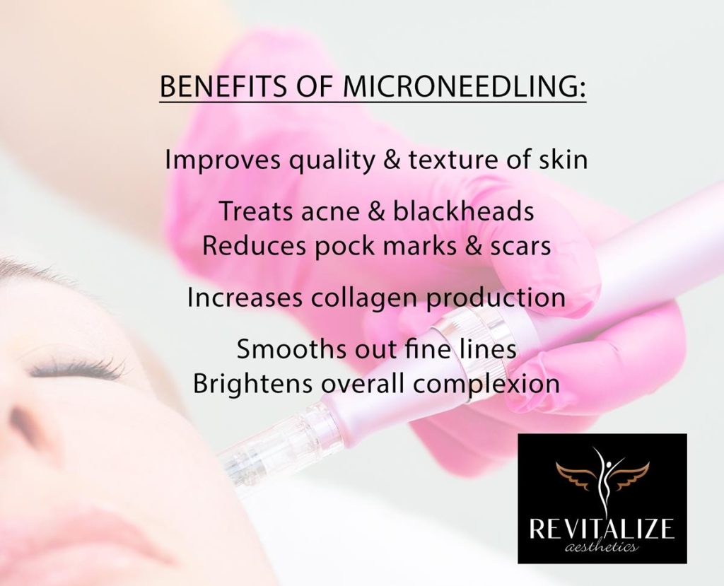 “Microneedling in Saint Charles, IL - Revitalize Aesthetics